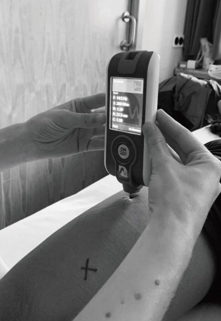 Muscle Tone, Stiffness, and Elasticity in Elite Female Cyclists after ...