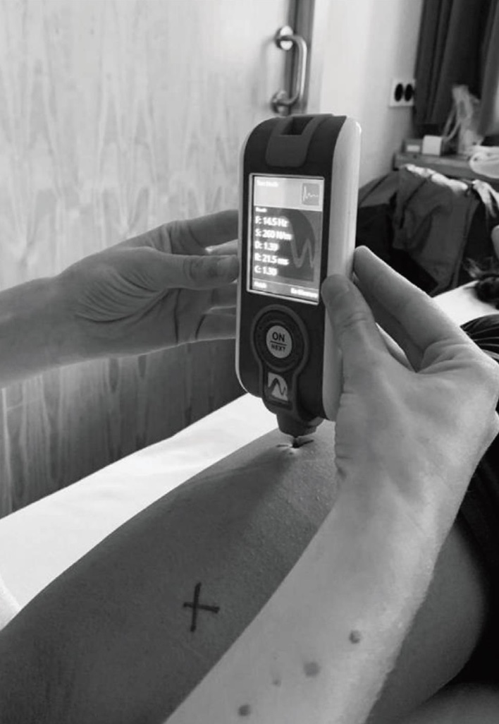 Muscle Tone, Stiffness, and Elasticity in Elite Female Cyclists after ...