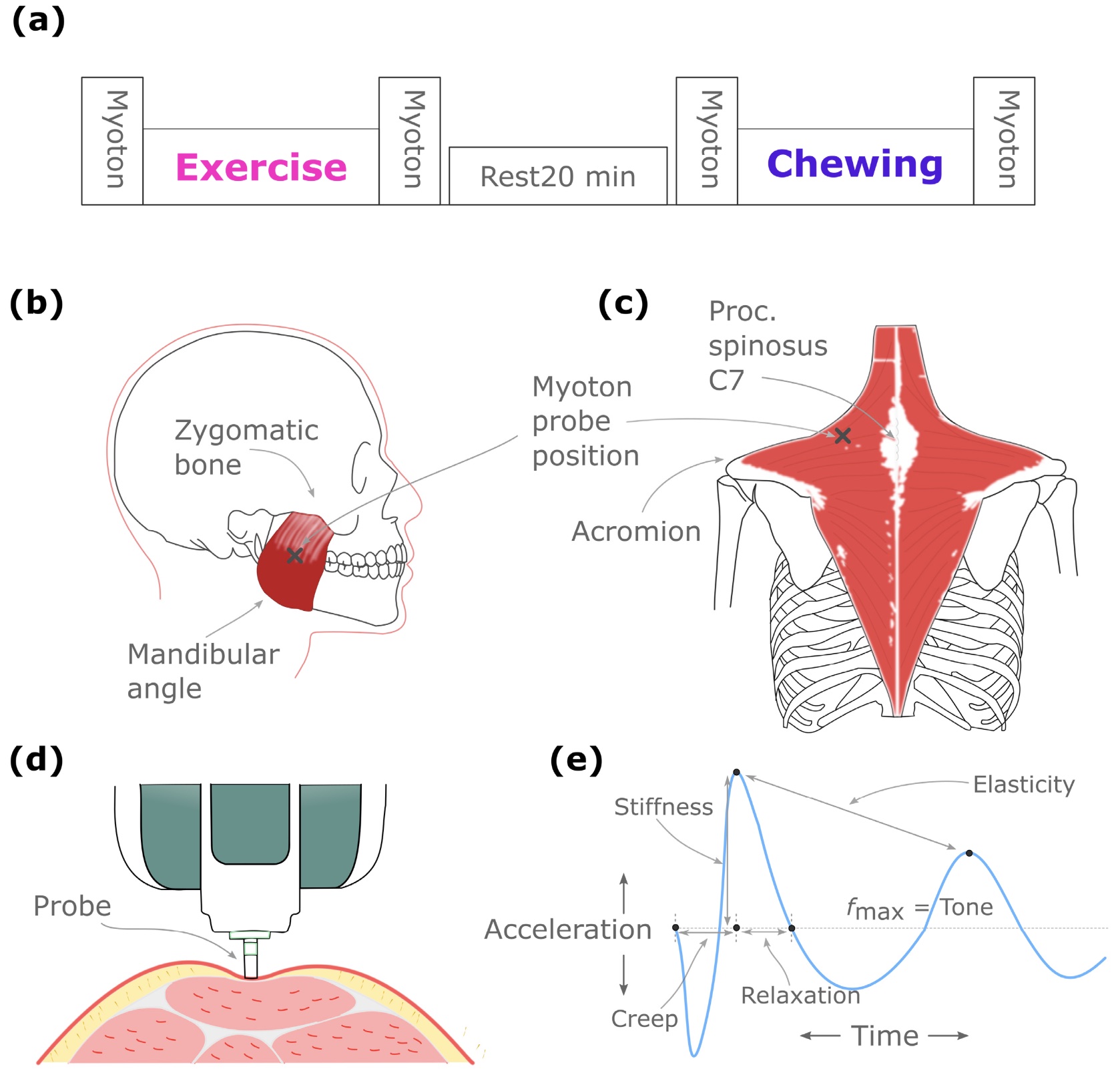 Acute Myotonometric Changes in the Masseter and Upper Trapezius Muscles ...