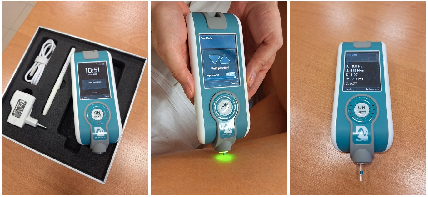 Monitoring Hip Joint Muscle Function in Osteoarthritis Patients ...